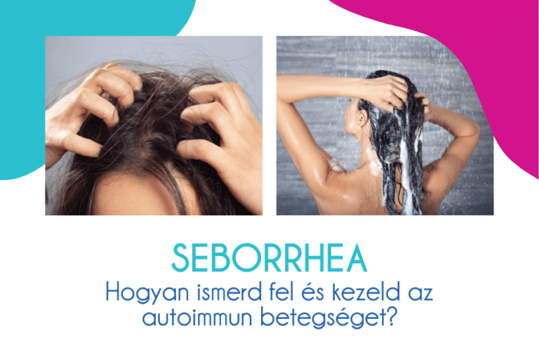 Seborrhea - Oxygeni Hair & Skin - Hajgyógyászati és kozmetikai ...