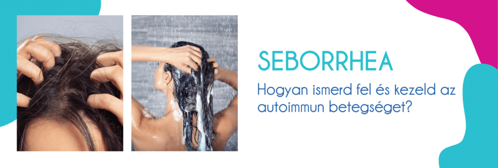 Seborrhea - Oxygeni Hair & Skin - Hajgyógyászati és kozmetikai ...